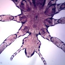 Pediculus Humanus, w.m., Microscope Slide | Carolina Biological Supply