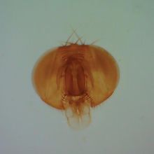 Musca domestica Head, w.m. Microscope Slide | Carolina Biological Supply