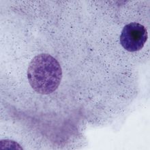 Barr Bodies - Female, smear Microscope Slide | Carolina Biological Supply