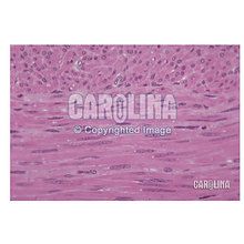 Human Muscle Tissues Microscope Slide Set | Carolina Biological Supply