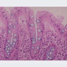Basic Epithelium Types Microscope Slide Set | Carolina Biological Supply