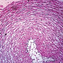 Mucous Tissue, cross section, Microscope Slide | Carolina Biological Supply