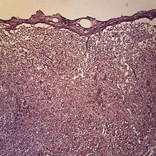 Loose and Dense Connective Tissues Microscope Slides | Carolina ...