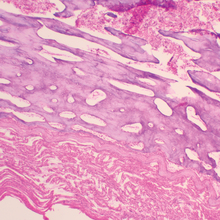 Bone Microscope Slides | Carolina Biological Supply
