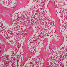 Mammal Bone Marrow sec. 7 µm H&E Microscope Slide | Carolina Biological Supply