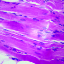 Skeletal Muscle Microscope Slides | Carolina Biological Supply
