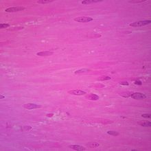 Human Smooth Muscle, sec. Thin Microscope Slide | Carolina Biological ...