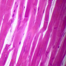 Human Cardiac Muscle Slide, 7 µm, H&E | Carolina Biological Supply