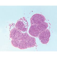 Nerve, cross section, Microscope Slide | Carolina Biological Supply
