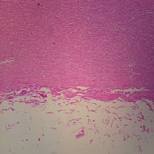 Human Aorta c.s. 7 µm H&E Microscope Slide | Carolina Biological Supply