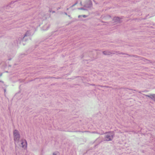 Mammal Purkinje Fibers sec. 7 µm H&E stain Microscope Slide | Carolina ...