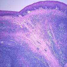 Human Palatine Tonsil sec. 7 µ H&E stain Microscope Slide | Carolina ...