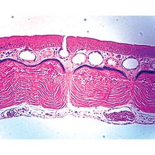 Skin, Frog, Sec. Microscope Slide | Carolina Biological Supply