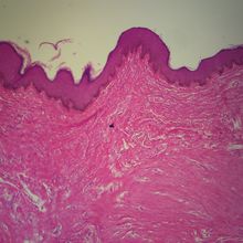 Human Heavily Pigmented Skin sec. 7 µm H&E stain Microscope Slide ...