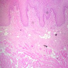 Human Tongue, Filiform Papillae, sec., 7 µm, H&E Microscope Slide ...