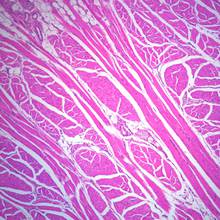 Human Tongue, Fungiform Papillae, sec., 7 µm, H&E Microscope Slide ...