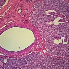 Human Sublingual or Submandibular Gland, Microscope Slides | Carolina ...