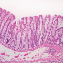 Colon Slide Labeled