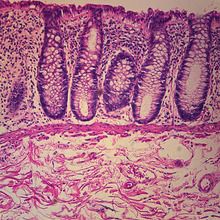 Human Colon Microscope Slides, 7 µm | Carolina Biological Supply