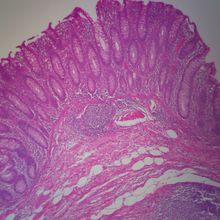 Human Colon, sec. 7 µm H&E Microscope Slide | Carolina Biological Supply