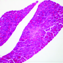 Human Pancreas, sec. 7 µm H&E Microscope Slide | Carolina Biological Supply