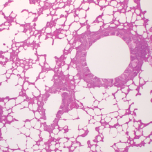 Lung Microscope Slide Labeled