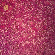 Human Kidney, sec. 7 µm H&E Microscope Slide | Carolina Biological Supply