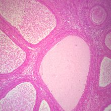 Mammal Ovary Follicles, sec. 7 µm, H&E Microscope Slide | Carolina ...