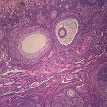 Mammal Graafian Follicles, sec. 7 µm H&E Microscope Slide | Carolina ...