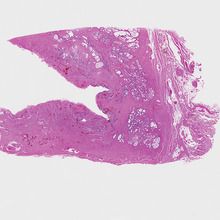 Human Prostate Gland - Young, sec. 7 µm, H&E Microscope Slide ...