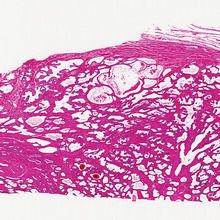 Human Prostate Gland - Older, sec. 7 µm, H&E Microscope Slide ...