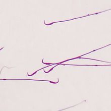 Mammal Rat Sperm, smear Microscope Slide | Carolina Biological Supply