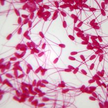 Mammal Bull Sperm, smear Microscope Slide | Carolina Biological Supply