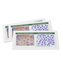 Card, Cells Splitting, Pack of 16 | Carolina Biological Supply
