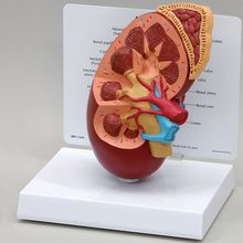 GPI Anatomicals® Human Kidney Model | Carolina Biological Supply