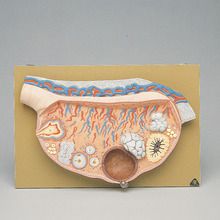 Somso® Human Female Ovary Model | Carolina Biological Supply
