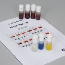 Blood Cells/Antisera Set | Carolina Biological Supply