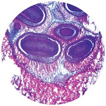 Cyathus Fruiting Body Slide, sec. | Carolina Biological Supply