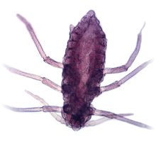 Aphids, w.m., Microscope Slide | Carolina Biological Supply