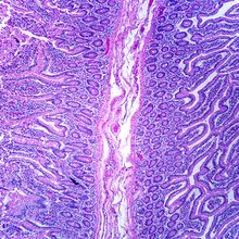 Duodenum, Lower CS., Microscope Slide | Carolina Biological Supply