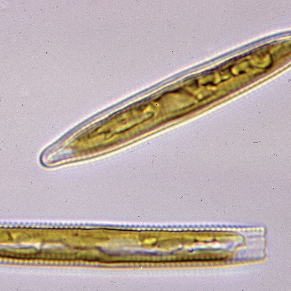 Synedra, Living | Carolina Biological Supply