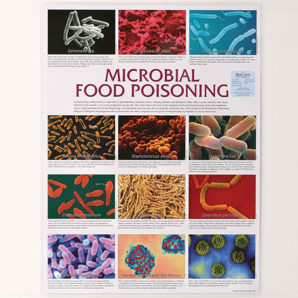 Microbial Food Poisoning Pictomicrograph | Carolina.com