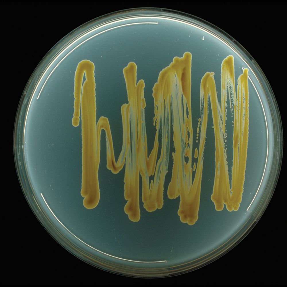 Micrococcus luteus, MicroKwik Culture®, Vial | Carolina.com