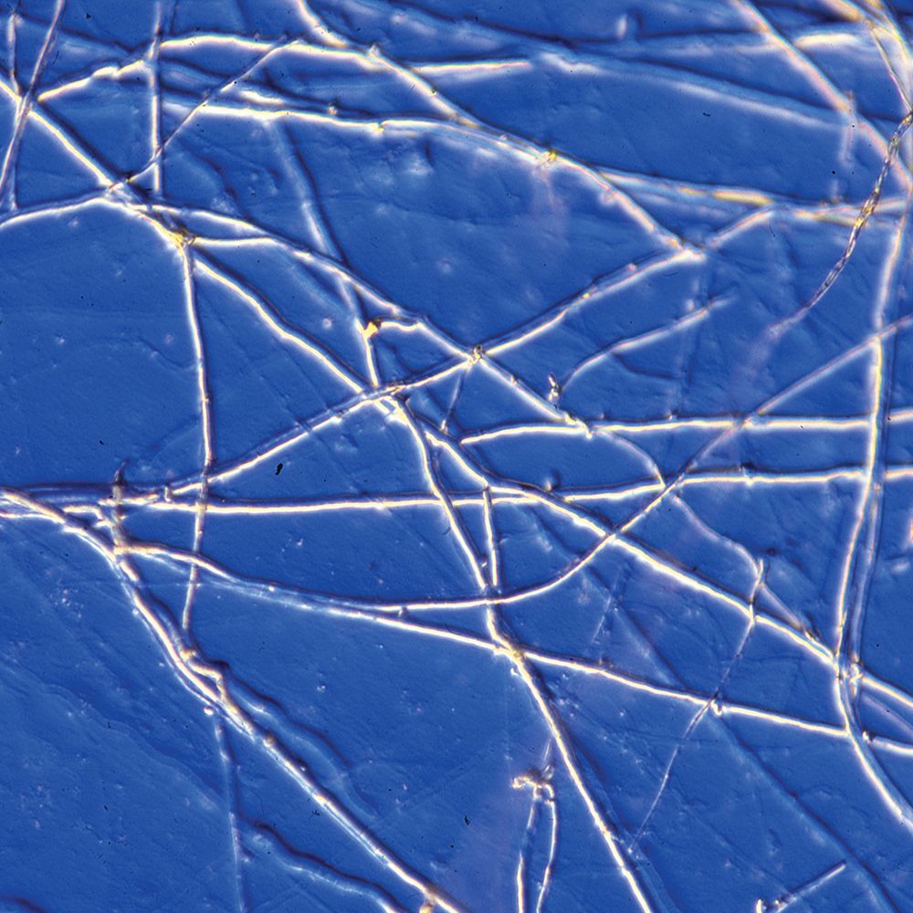 Arthrobotrys conoides, Living, Plate | Carolina Biological Supply