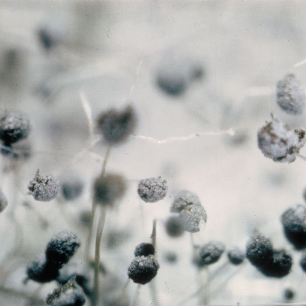 Rhizopus Stolonifer Under Microscope