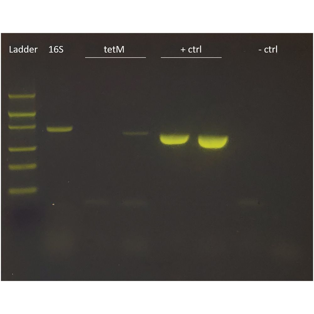 eDNA: Sampling Soil for Antibiotic Resistance Kit (with consumables ...