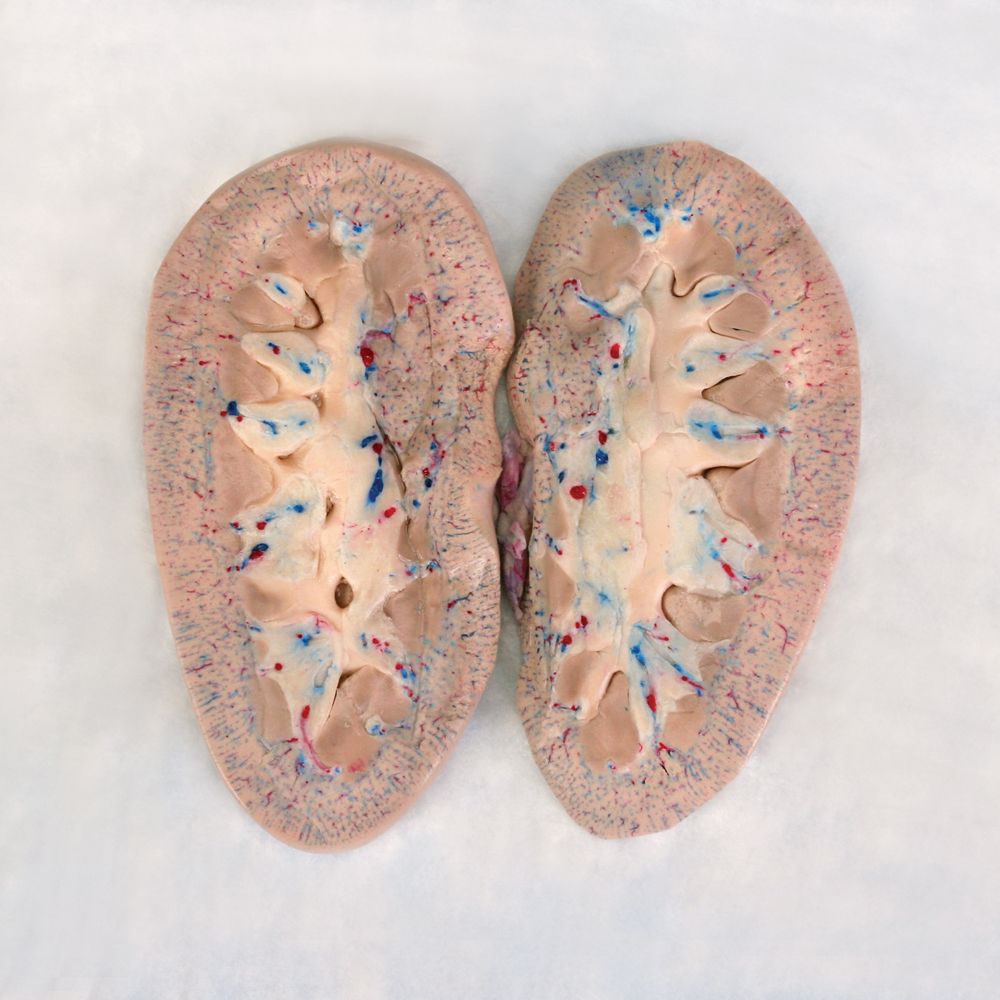 Carolina's Perfect Solution® Pig Kidney, Double Injection, 1 Per Bag ...