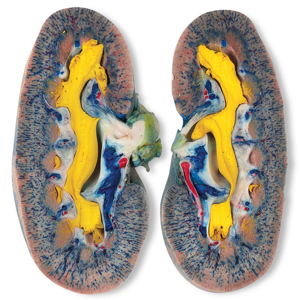 Carolina's Perfect Solution® Pig Kidney, Triple Injection, Pail ...