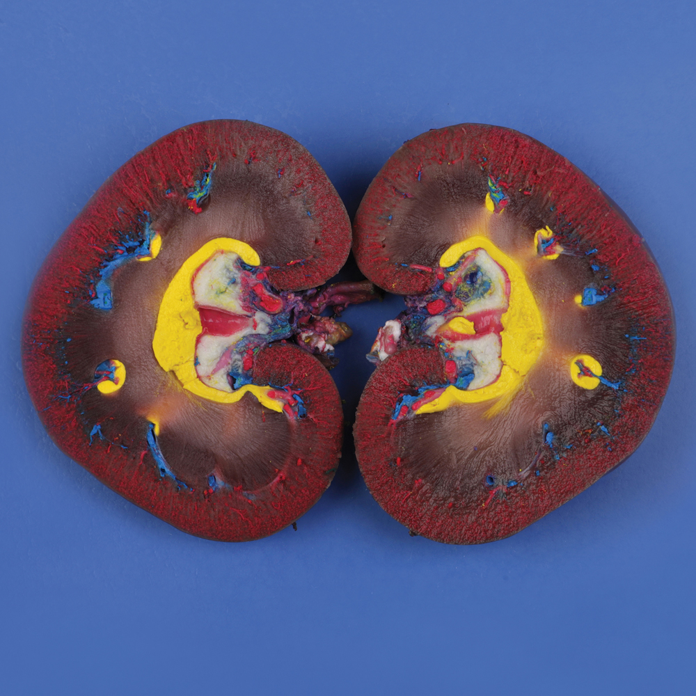 Formalin Sheep Kidney, Triple Injection, 1 Per Bag | Carolina ...