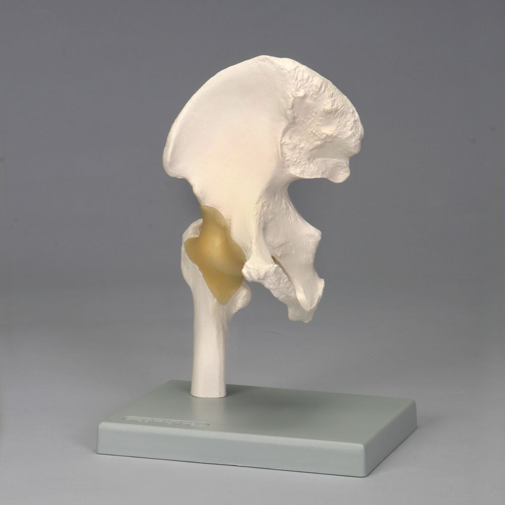 Human Hip Joint Model | Carolina.com